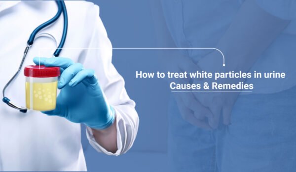 Various Causes & Symptoms of White Particles in Urine